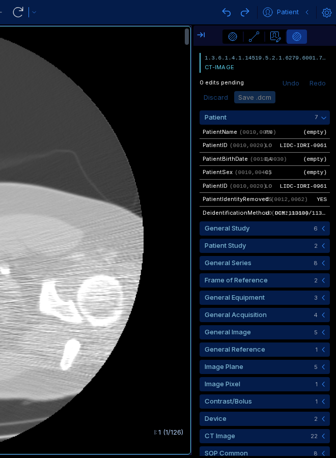 Free DICOM Viewer — Open .dcm Files Online — Saga IT